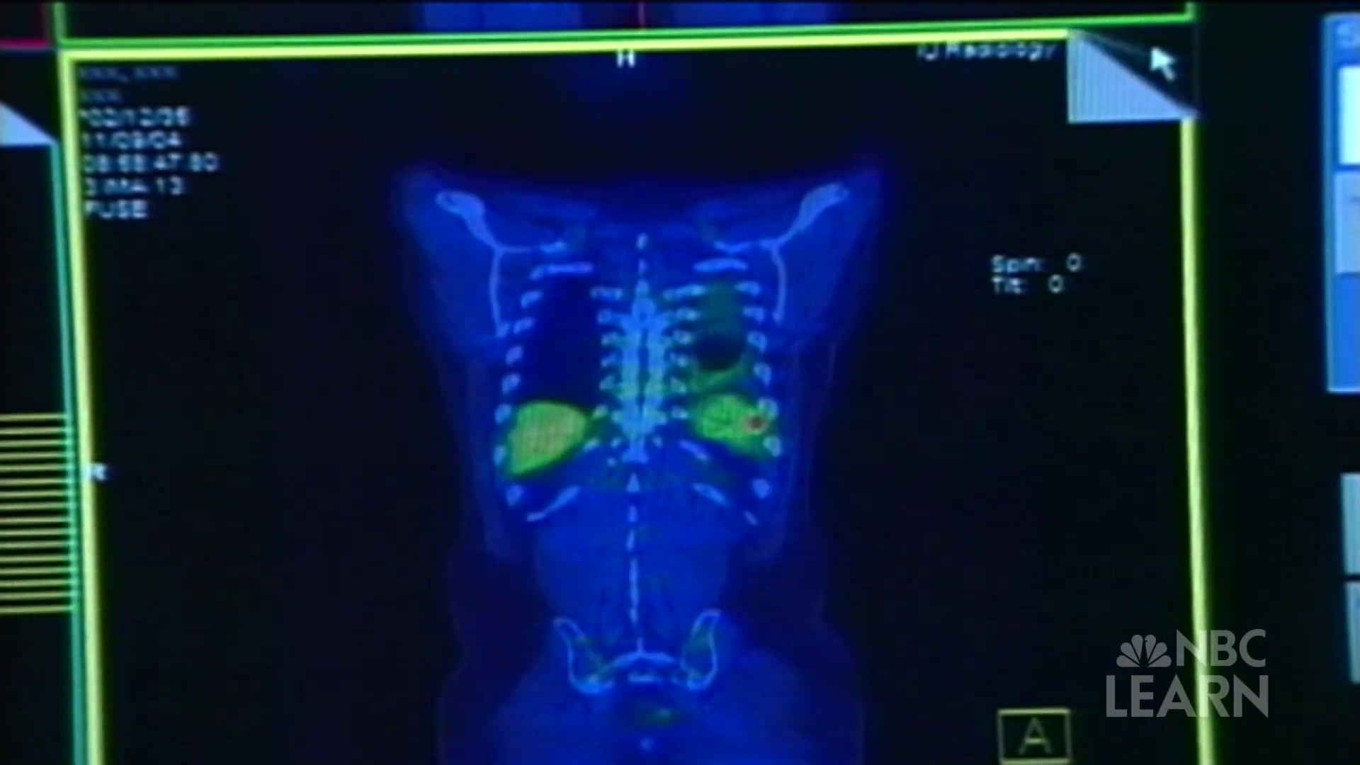 Electronic Tattoos: The Future of Wearable Health Tech