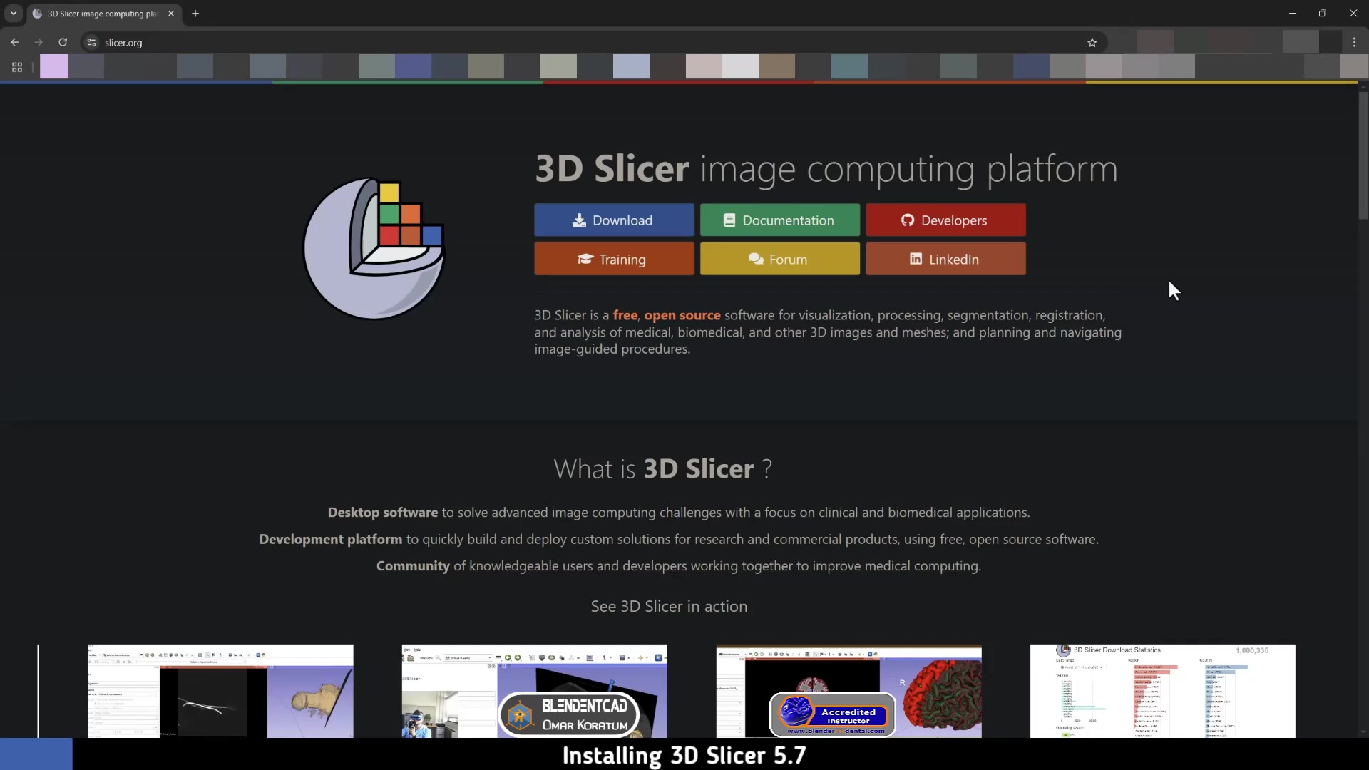 3D Slicer Dental Segmentator: 安装指南与使用技巧