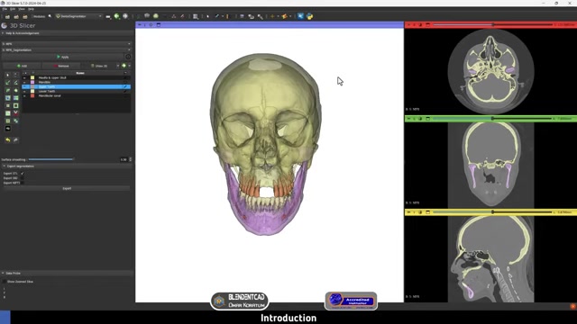 3D Slicer Dental Segmentator: 安装指南与使用技巧